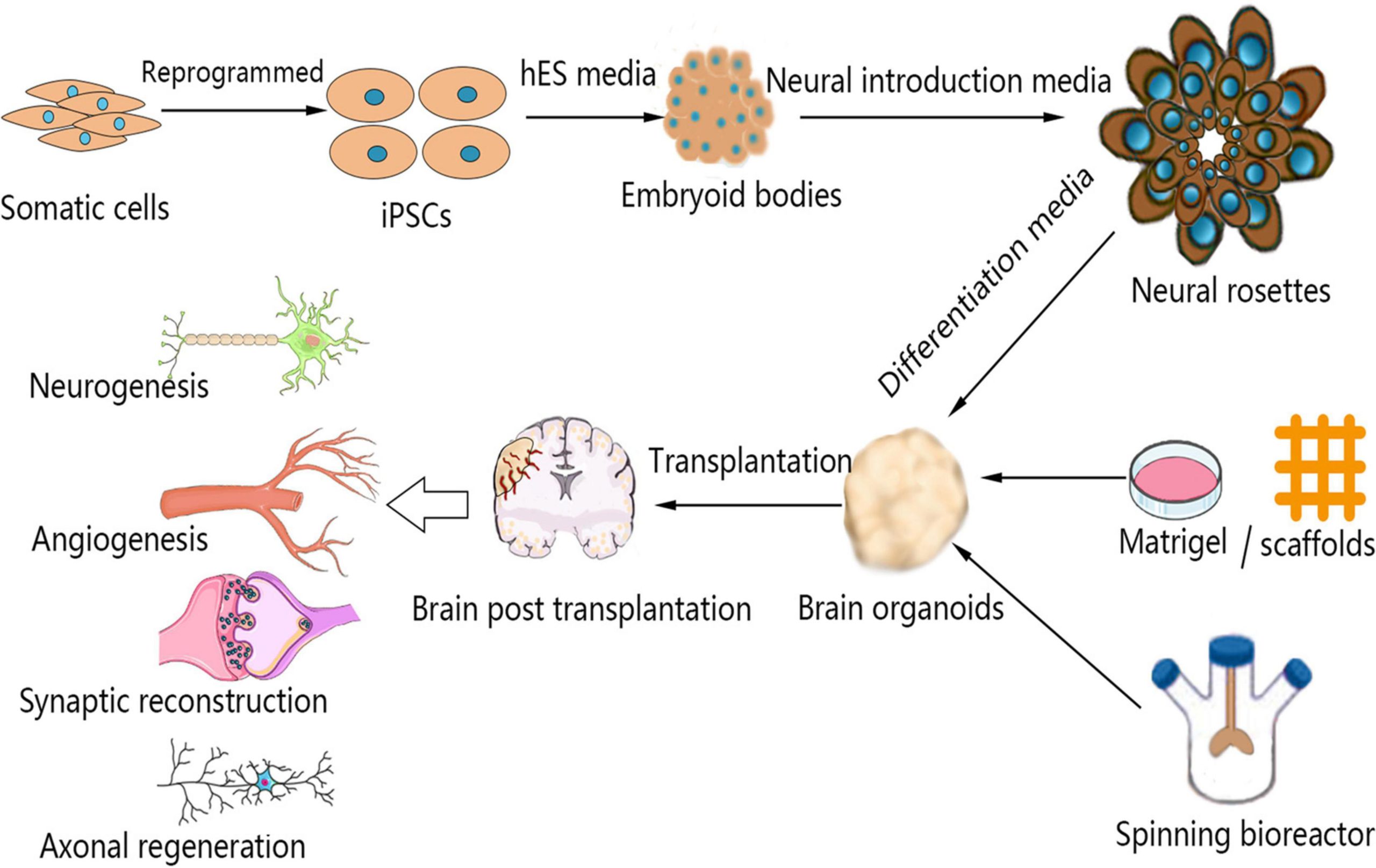 Brain organoids: neural development and neurological diseases - faCellitate