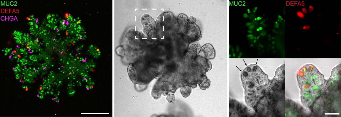 Gut-on-a-chip: mimicking the human intestine with organoids - faCellitate