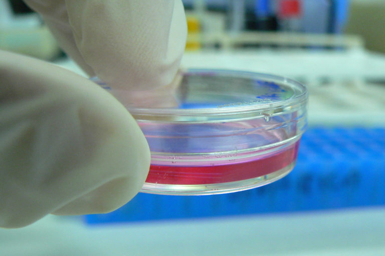 Cell culture media preparation: Significant impact on cell growth ...